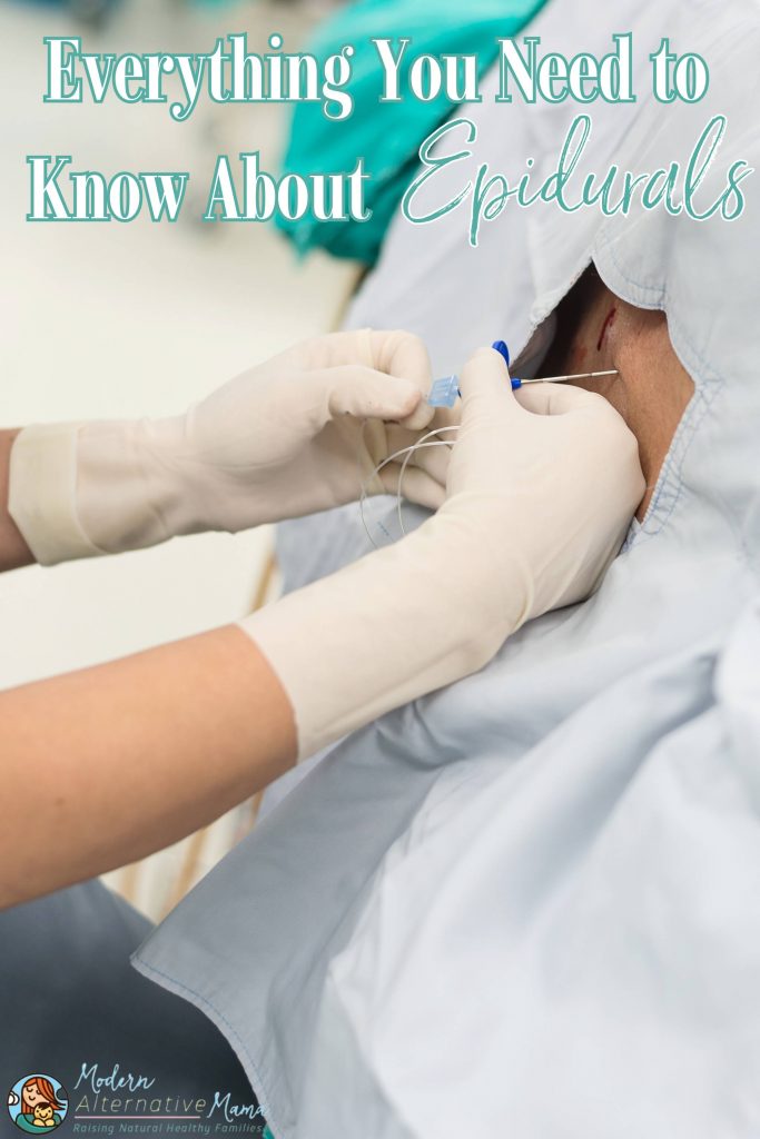 Everything You Need to Know About Epidurals